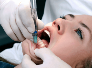 CALAJECT™ - RØNVIG Dental Mfg. A/S